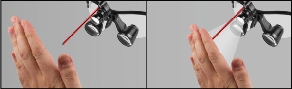 SurgiTel | LED Headlights | Dental Loupes with Light | Surgical ...